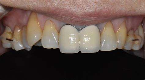 채움과이음치과