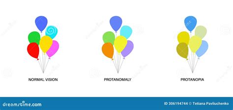 Protanomaly And Protanopia Stock Illustration Illustration Of