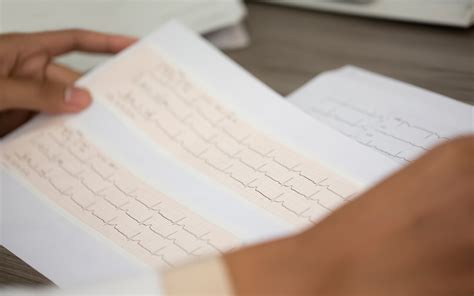 Understanding Premature Ventricular Contractions Pvcs Kardia