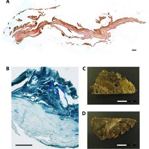 Paraffin Cross Section Of Skin Tissue Of The Thoracic Back Side Of The
