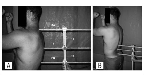 A Using The Arcometer In The Thoracic Spine With Identification Of