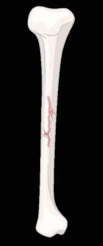 MSK Patho Flashcards Quizlet