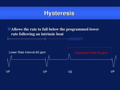 Ppt Pacemaker Timing Part I Powerpoint Presentation Free Download