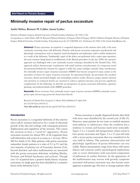 Pdf Minimally Invasive Repair Of Pectus Excavatum