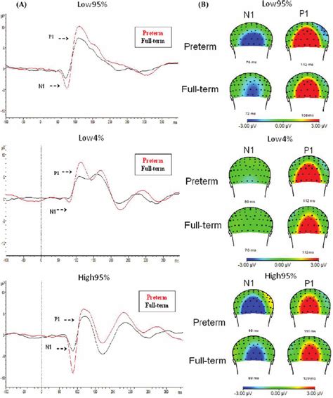 A Grand Average Visual Evoked Potentials Veps From The Central