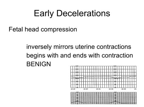4 Stages Of Labor Ppt
