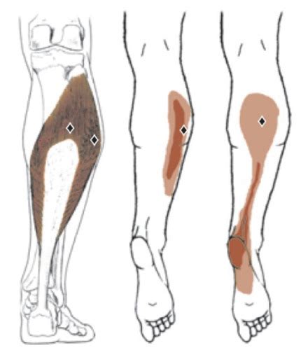 Soft Tissue Exam Two Trigger Points Flashcards Quizlet
