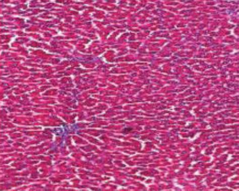 Masson Trichrome Staining Analysis Liver Tissues Showing The Normal