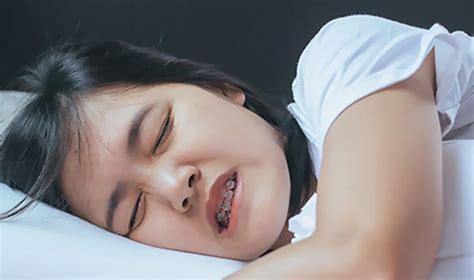 علت و روش های درمان دندان قروچه