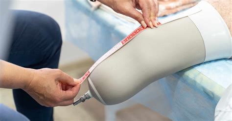 Все про протезування кінцівок в Україні Цензор НЕТ