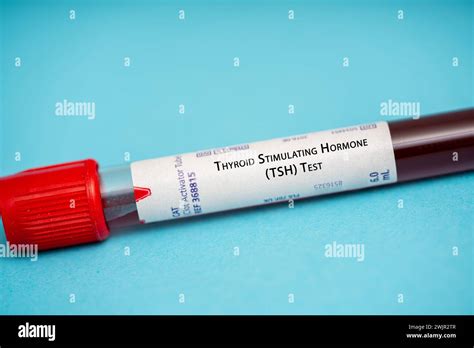 Thyroid Stimulating Hormone Test Stock Photo Alamy