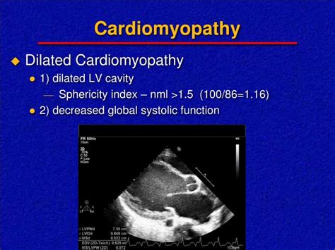 Icd 10 Code For Normal Lv Systolic Function