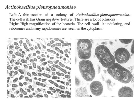 Niahniah Pathogenic Organisms Observed By Electron Microscope