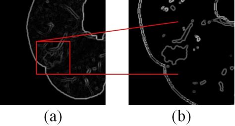 A Image Gradients B Tensor Gradients Obtained From Se Download Scientific Diagram