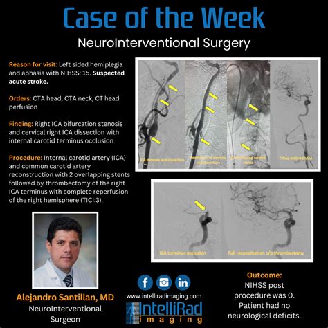 Case Of The Week Stroke Alert Intellirad Imaging