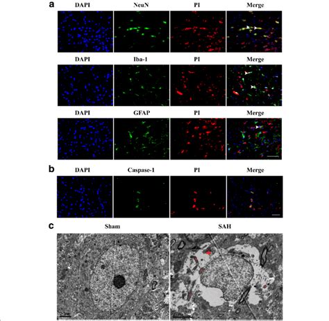 Double Staining For Pi With Neun Neuron Marker Iba 1 Microglia Download Scientific Diagram