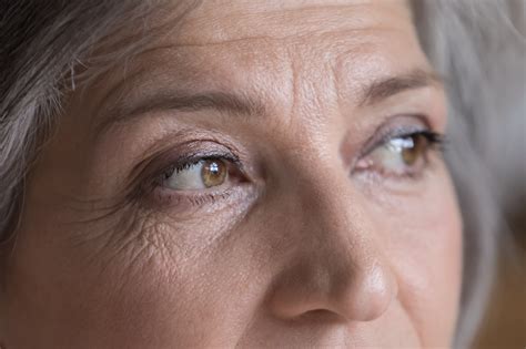 Les Formes Mixtes De Dmla Association Dmla