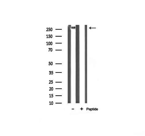 Anti Flna Filamin A Antibody Rabbit Anti Human Polyclonal Lsbio