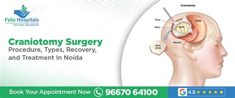 Craniotomy Surgery Procedure Types Recovery And Treatment In Noida