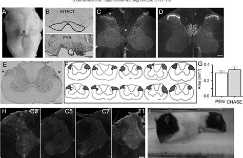 Figure 1 From Plasticity Of Subcortical Pathways Promote Recovery Of Skilled Hand Function In