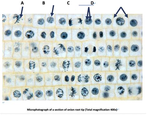 Solved Describe The Shape Of Onion Root Tip Cells Shown At Chegg Com