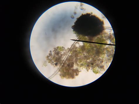 Microscopy Pond Water