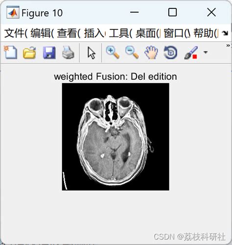 【图像融合】用于图像融合方法、客观评估指标、弗里德曼friedman统计检验及其事后检验研究（matlab代码实现）friedman