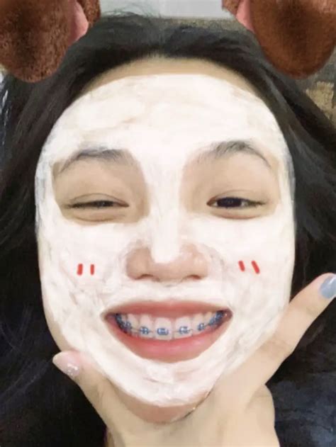 สียางจัดฟัน 💫 แกลเลอรีที่โพสต์โดย ค อ น ต อ น ☁️ Lemon8