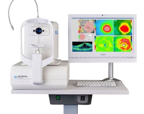 Oct Eye Testing Oakmead Opticians Chislehurst Bromley Bexley