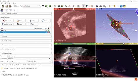 Extract The Annotated Plane In 3d Image Development 3d Slicer Community
