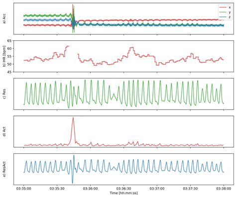 Overnight Sleep Staging Using Chest Worn Accelerometry