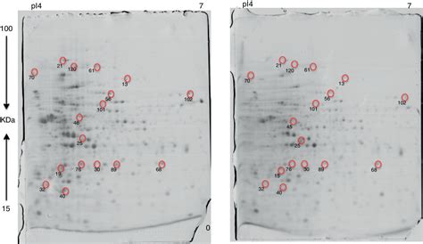 Characterization Of Rhodococcus Sp A5wh Isolated From A High Altitude Andean Lake To Unravel