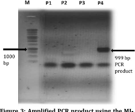 Figure 3 From Comparison Of Dna Extraction Protocols For Molecular