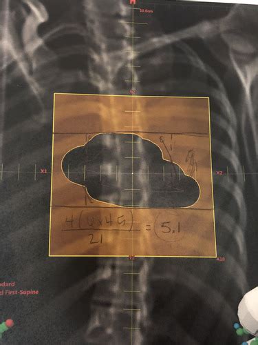 Dosimetry Exam 2 Module 11 Flashcards Quizlet