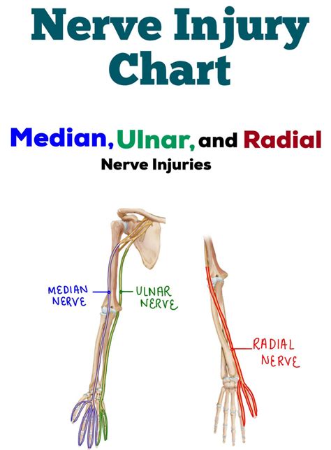 Nerve Injurydysfunction Chart Median Ulnar And Radial Nerves Etsy