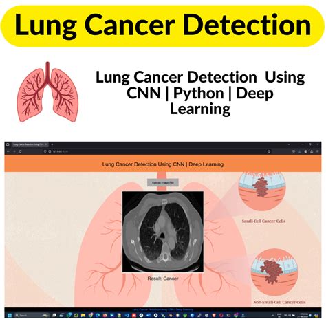 Lung Cancer Detection Using Cnn Project With Source Code Projectworlds Store