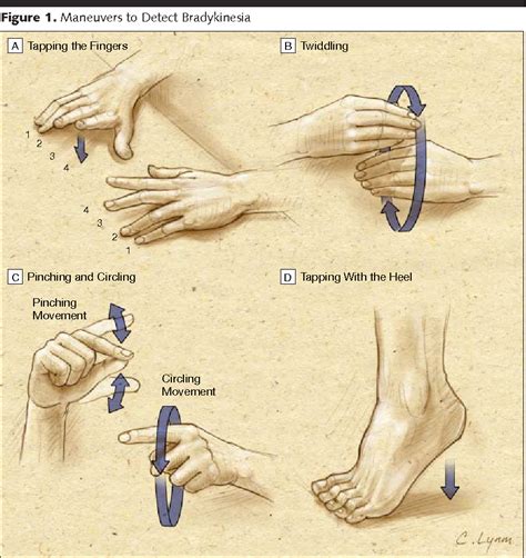 Finger Tapping Test At Jake Burdekin Blog