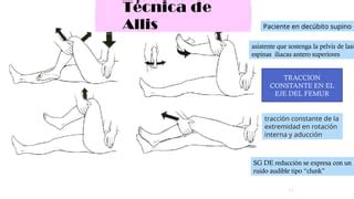 Anatomia De Articulacion Y Luxacion De Caderapptx