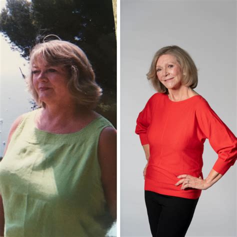 Weight Loss Doctor Bob Posner