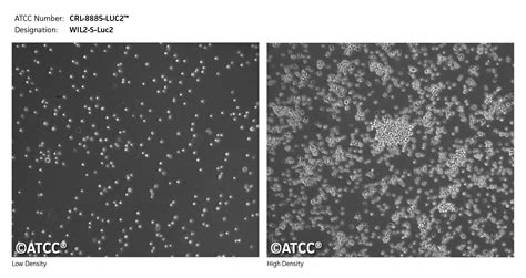 Wil2 S Luc2 Crl 8885 Luc2 Atcc