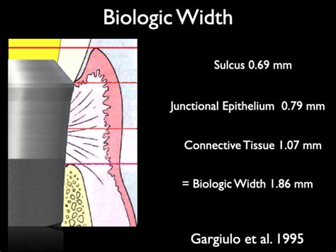 Biologic Width