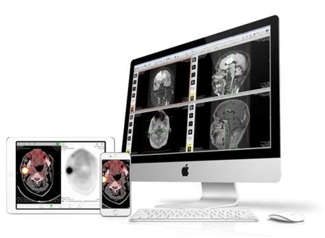 Osirix Dicom Viewer The World Famous Medical Imaging Viewer