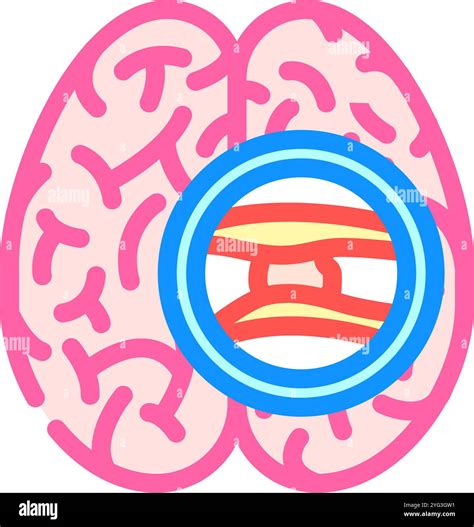 Stroke Man Disease Color Icon Vector Illustration Stock Vector Image And Art Alamy