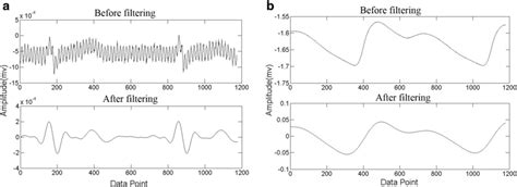 Signals Before And After Filtering A Ecg And B Ppg Download