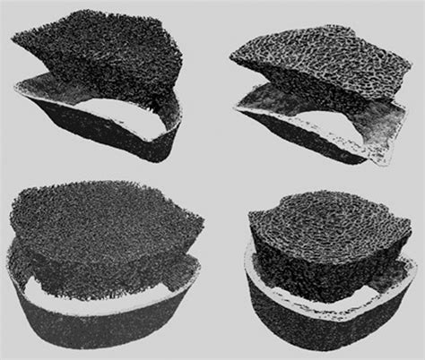 Representative High Resolution Peripheral Quantitative Computed Download Scientific Diagram