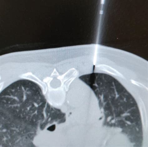 The Filipino Interventional Radiologist
