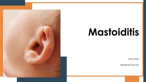 Mastoiditis Ppt Guidelines Acp Ppt Slide