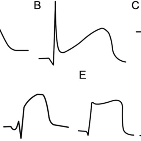 In The Acute Phase Of St Segment Elevation Myocardial Infarction Download Scientific Diagram