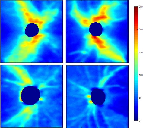 Figure 1 From Machine Learning Models For Diagnosing Glaucoma From Rnfl Thickness Maps
