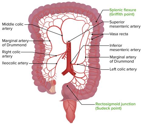 Mesenteric Ischemia Concise Medical Knowledge